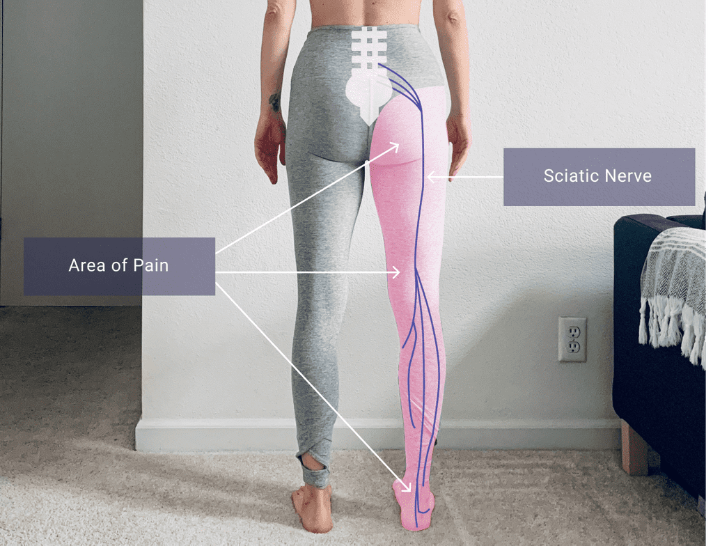 3 Stretches to Relieve Sciatica Pain. Do Them at Your Desk! | Blog